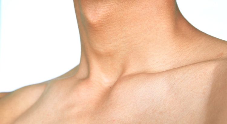 Faringite: cos'è, sintomi e rimedi naturali - Quotidiano di Ragusa